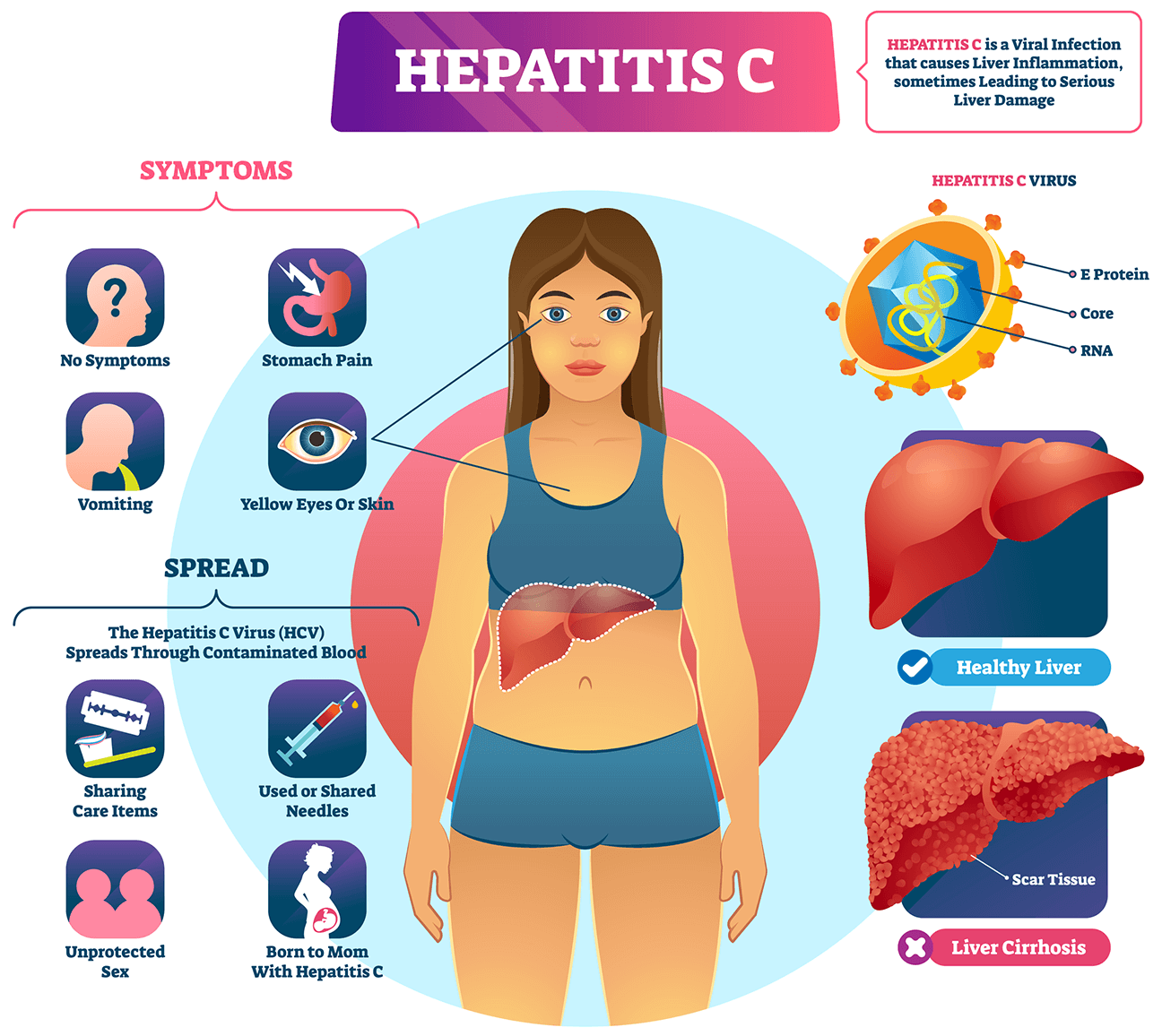 Most hepatitis C can be cured with simple treatment - Biskinik
